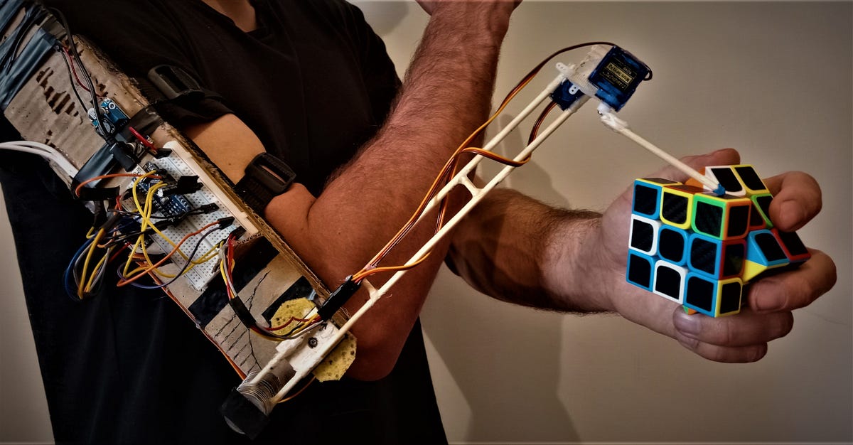 Upper limb prosthesis controlled by head tilting | by Weird Motions Lab ...