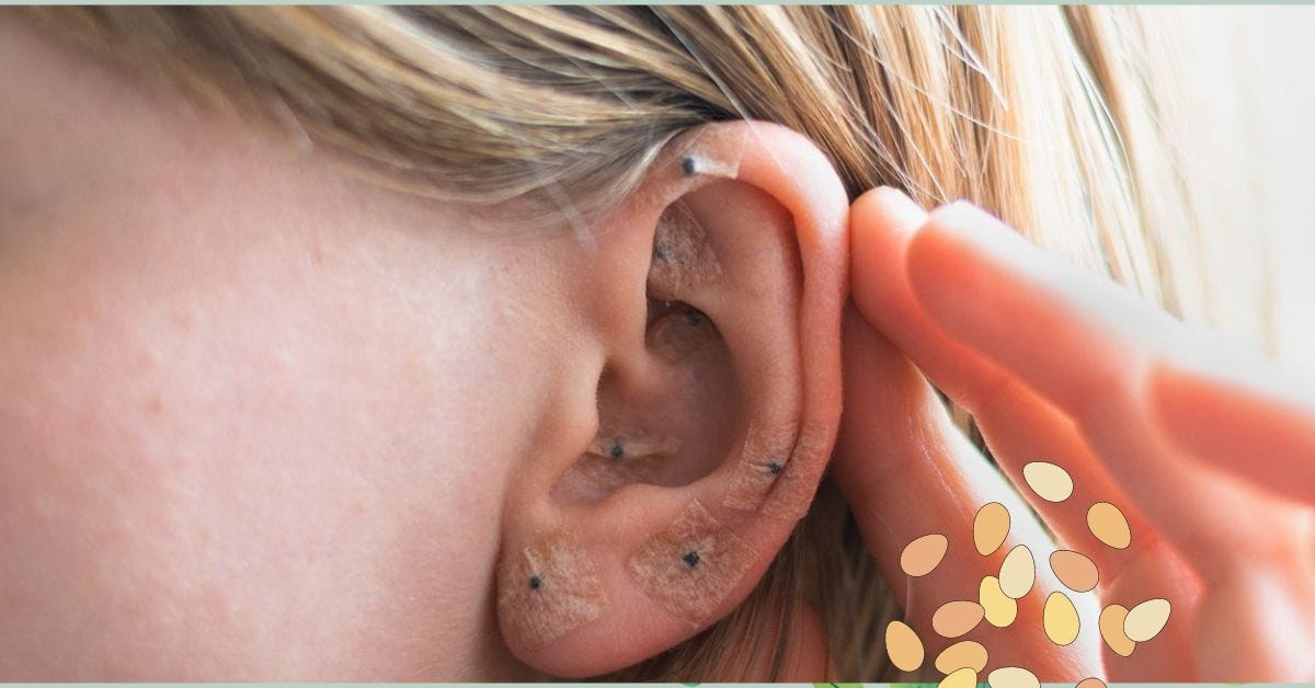 Ear Seeds For Weight Loss — Secret Weapon Revealed 2023 | by Fitu | Medium