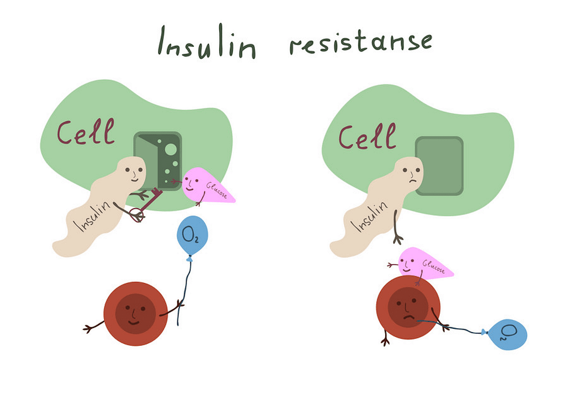 Latent Autoimmune Diabetes in Adults | by Samantha O'Connor, PA-C | Medium