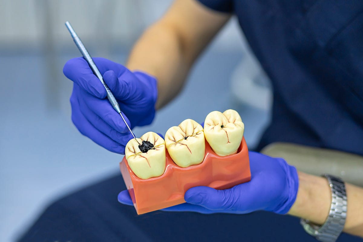 How Dentist Fix Cavities. Cavities are also known as dental… | by ...