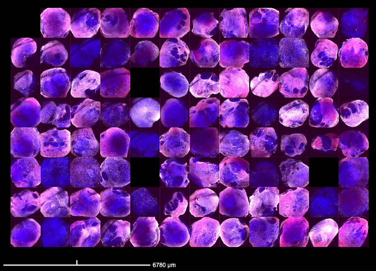 Herophilus Discovery Engine in action: Targeting synaptogenesis | by ...