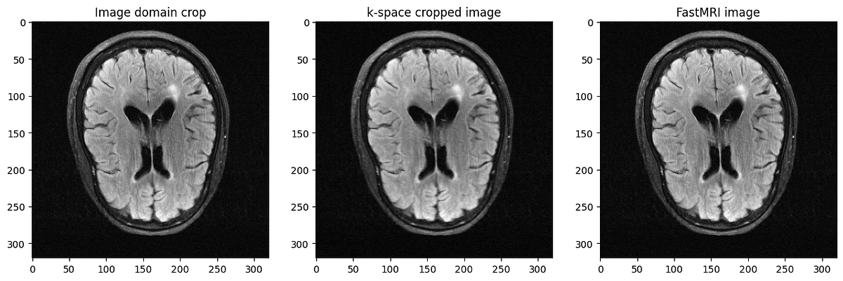 Visualising MRI data in Python. In this post, we will see how to… | by Nadav Levi | Medium