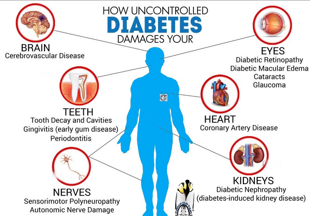 Best medicine for diabetes without side effects | by Ritusharma | Medium