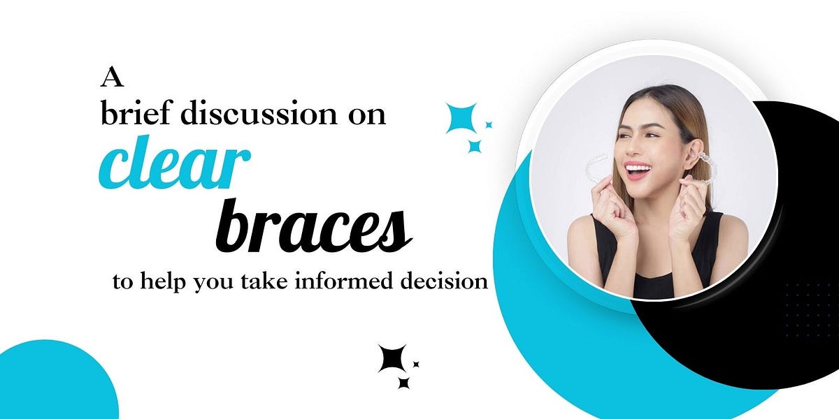 A brief discussion on clear braces to help you take informed decision ...