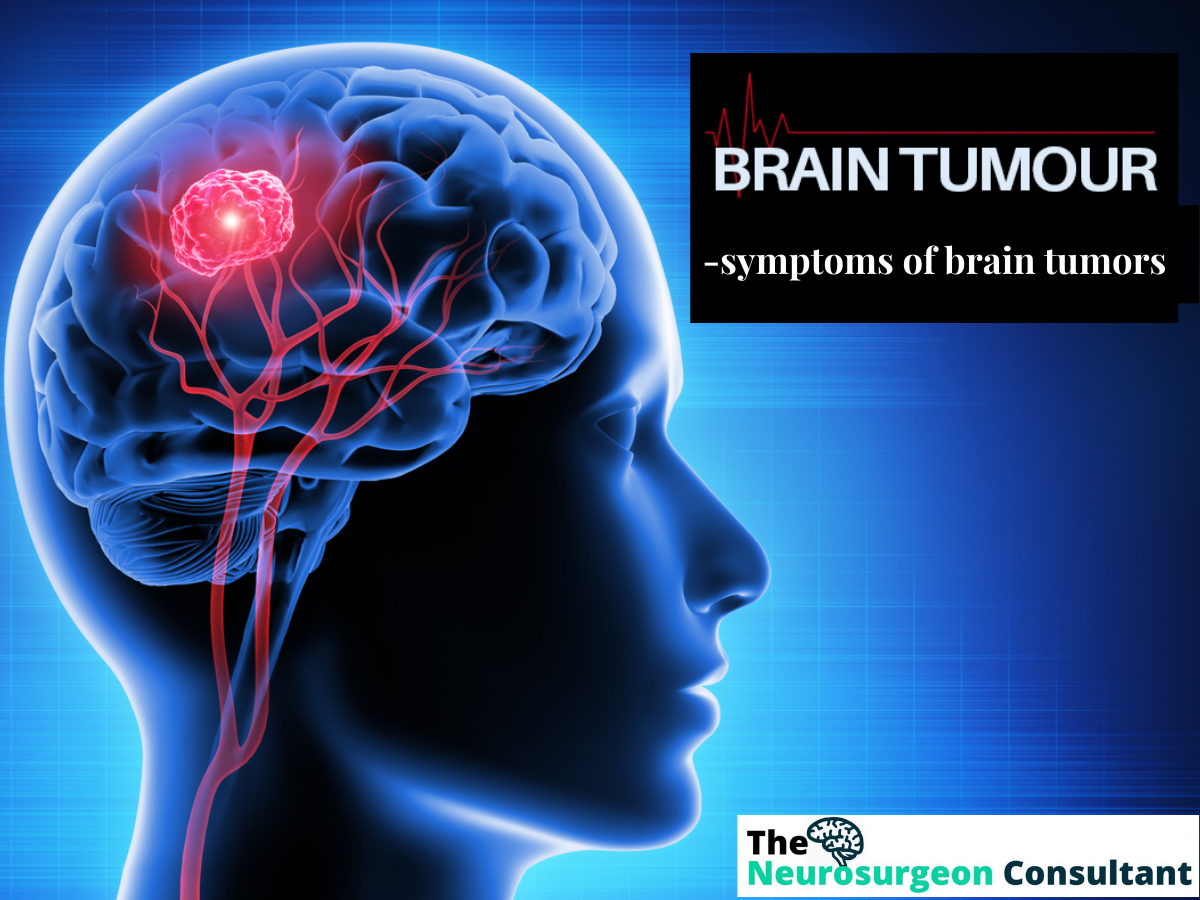 What are the symptoms of brain tumors? | by The Neuro Surgeon Consult ...