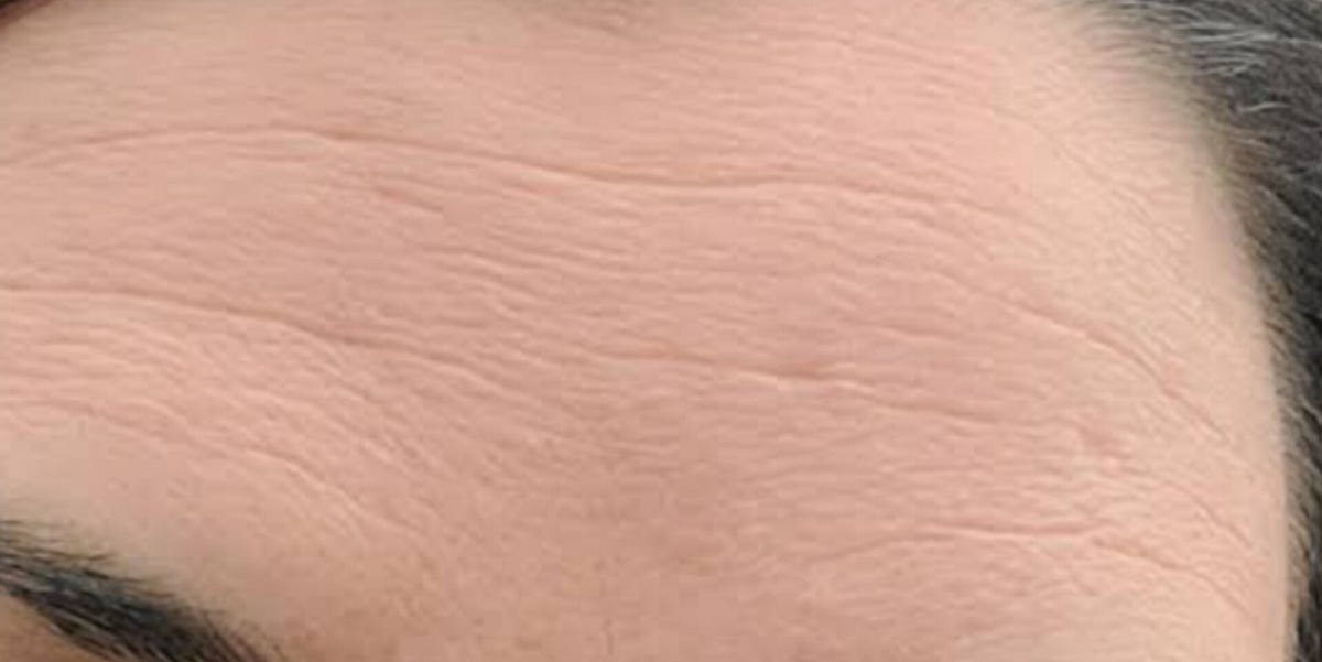 How to Keep Your Forehead Smooth and Wrinkle-Free | by Sajida Bibi ...