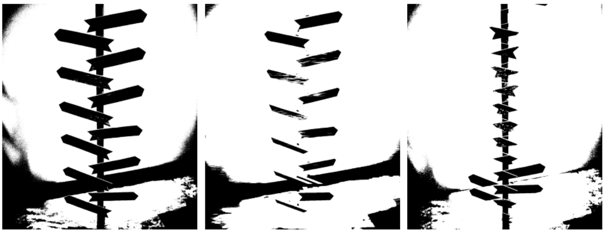 Image Processing using Morphological Operations | by Ralph Caubalejo | Towards AI