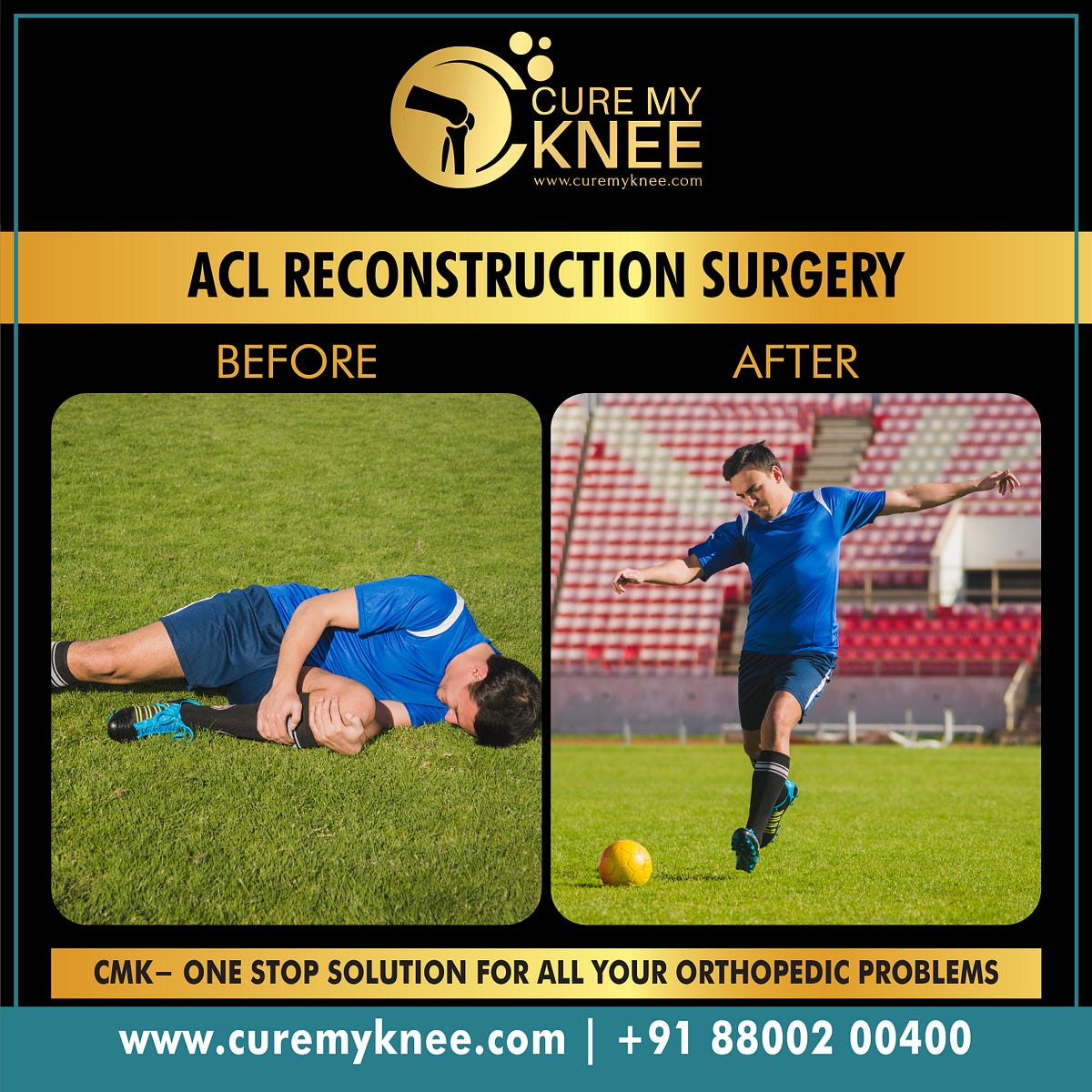 Acl Injury Treatment In Delhi. If you are an athlete, you might have ...