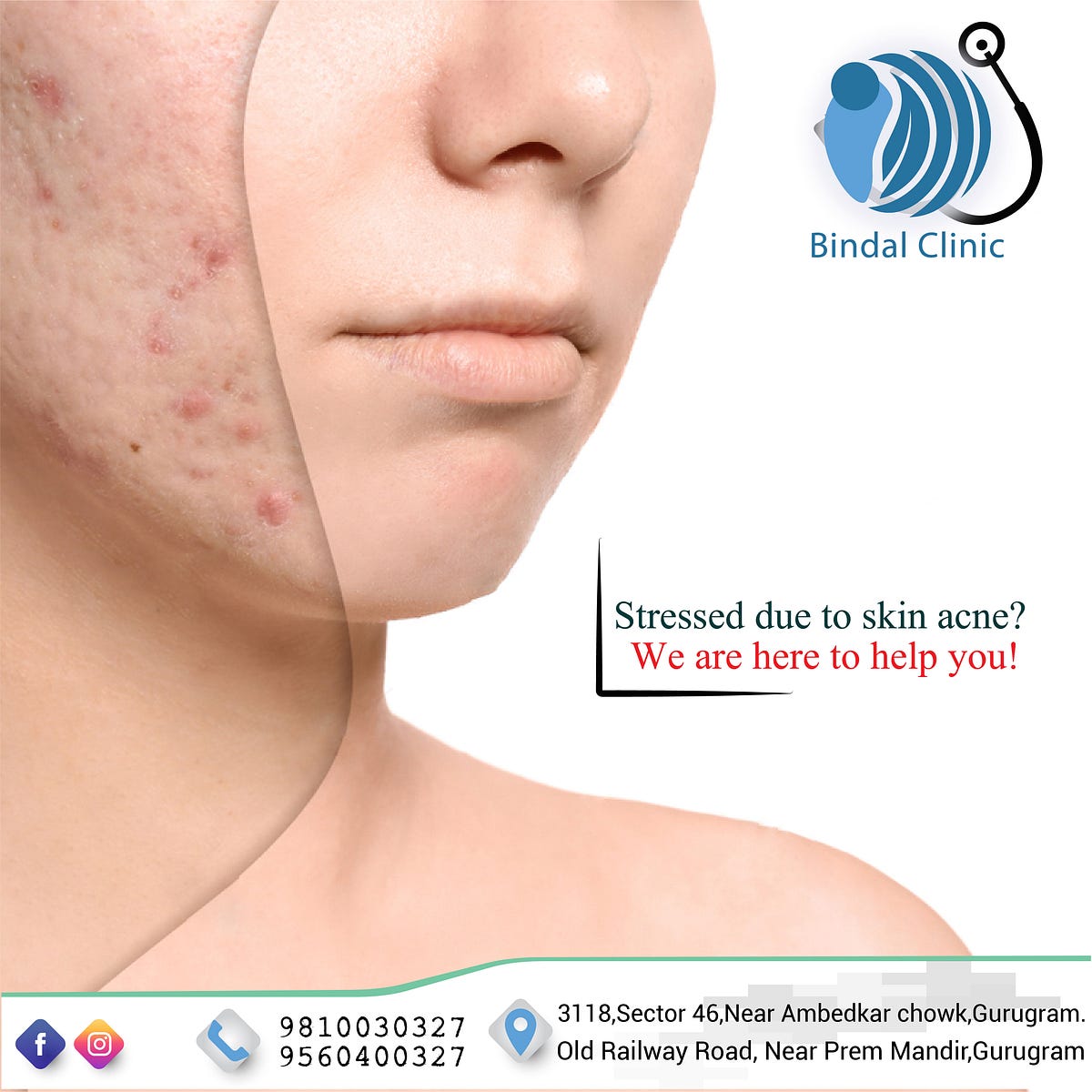 COMMON SKIN PROBLEMS THAT CAUSE PSYCHOLOGICAL EFFECTS IN YOUNGSTERS ...