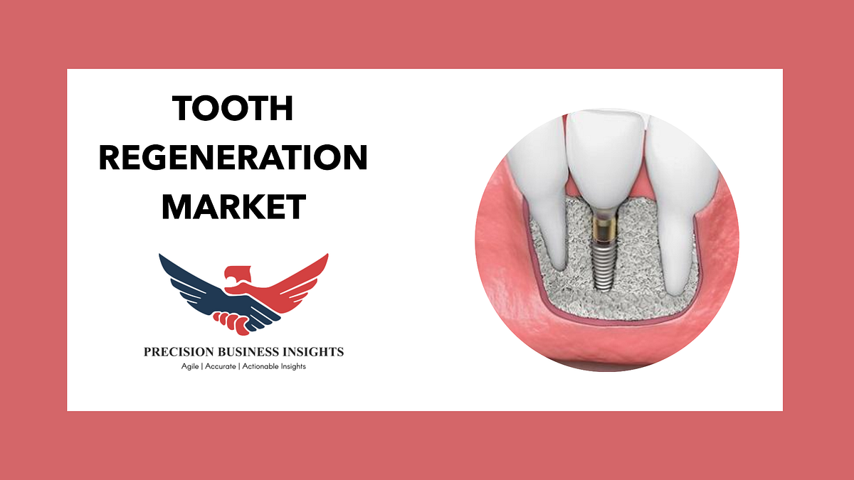 Tooth Regeneration Market Growth Drivers And Trends Forecast 2024–2030 | by Vamshikrishna | Apr ...