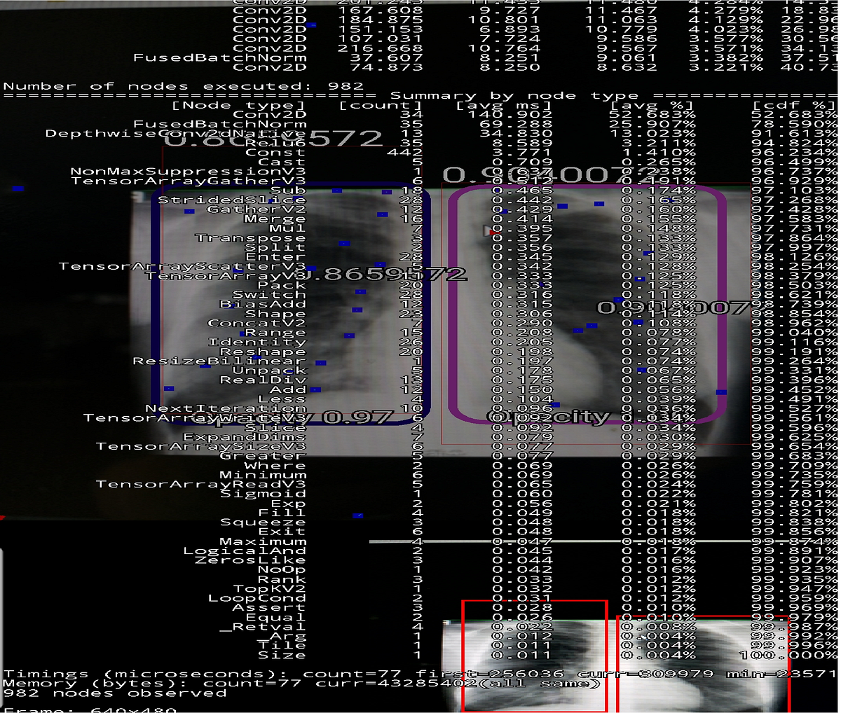 Tutorial: Real-time Android Object Detection of Pneumonia Chest X-Ray Opacities using SSD ...
