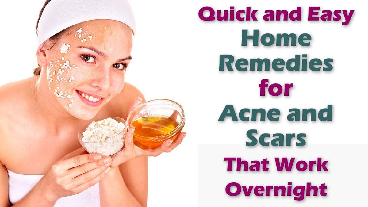 home remedy for acne. Acne is one of the most common skin… | by sana ...