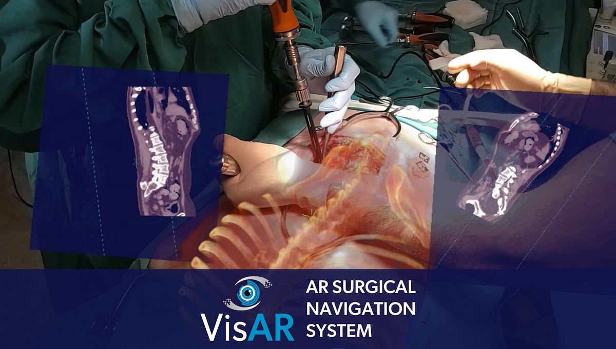 First Fully Immersive 3D AR Surgical Navigation System Achieves FDA ...