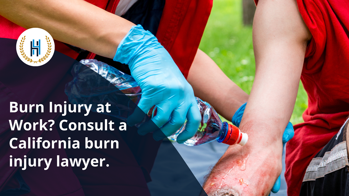Why hire a lawyer immediately after a workplace burn injury when it is ...