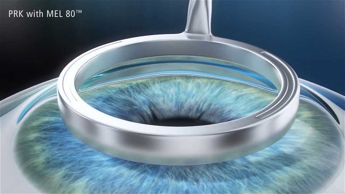 ASA Eye Surgery In Parrsboro. ASA Eye Surgery in Parrsboro, effects ...
