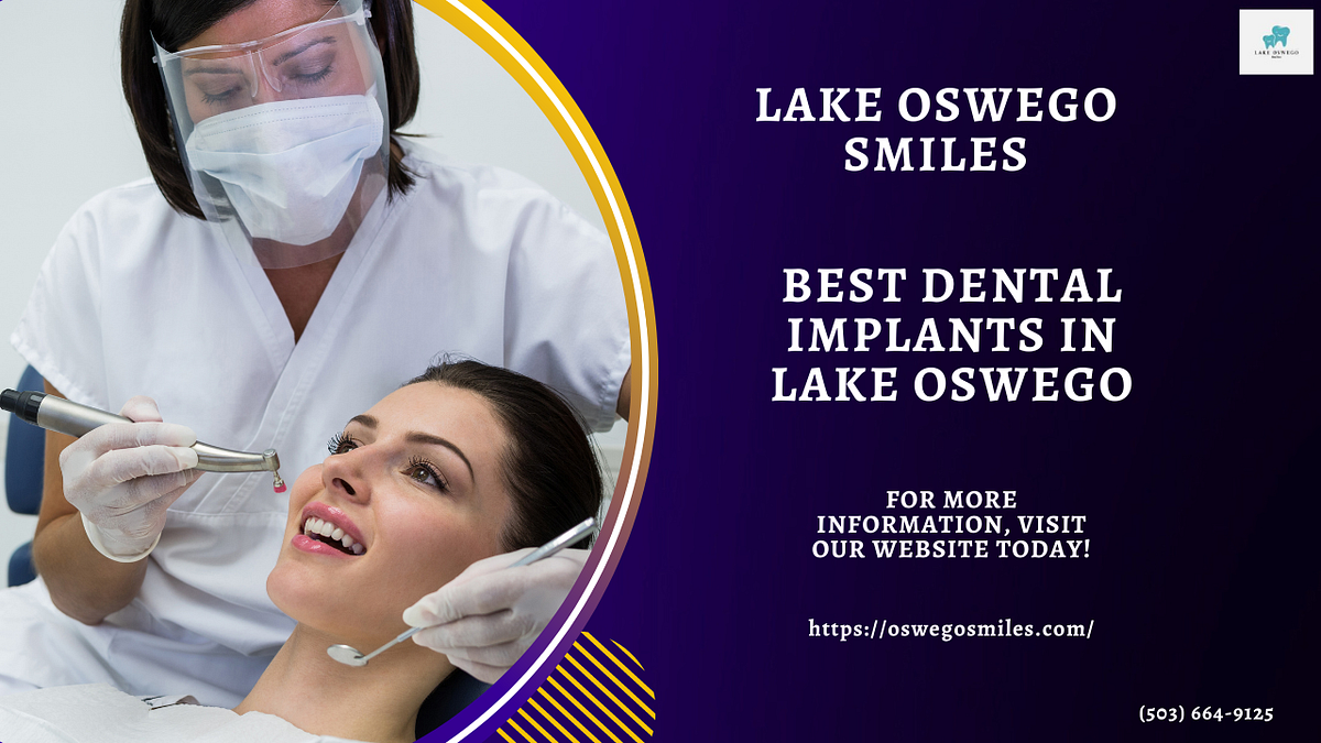 Best Dental Implants in Lake Oswego | Lake Oswego Smiles ...