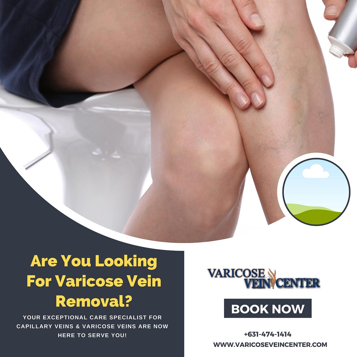 Varicose Vein Removal and Spider Vein Removal | by Varicose Vein Center ...