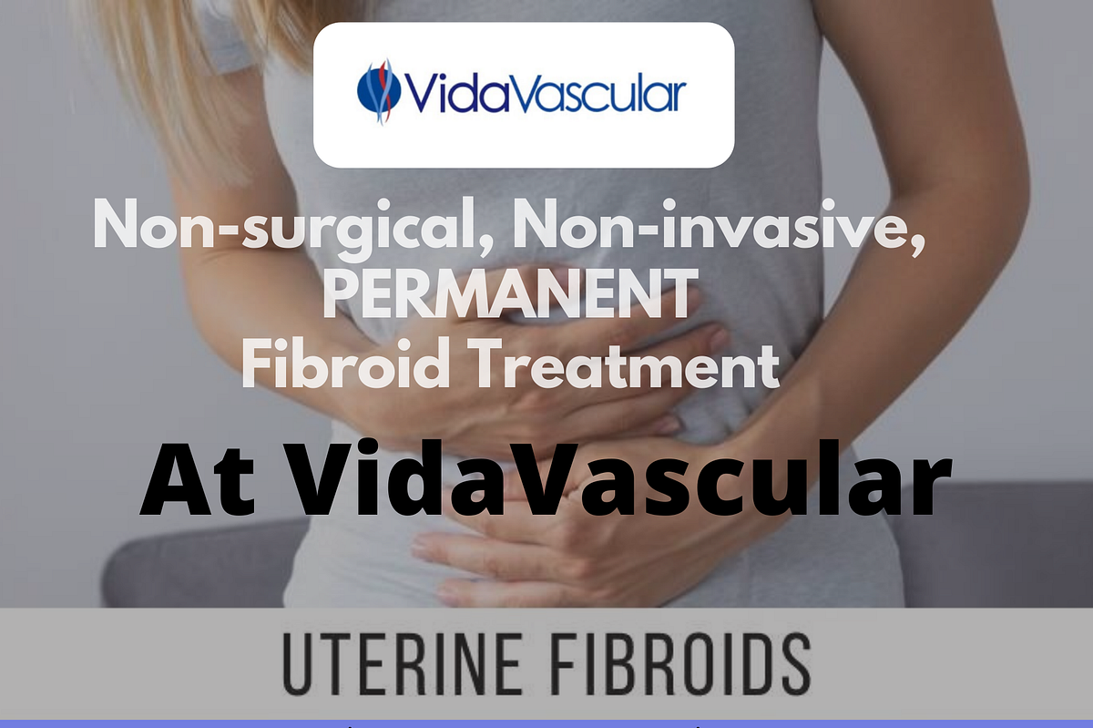 Uterine Fibroid Embolization: How to Get Relief from Fibroids? | by ...