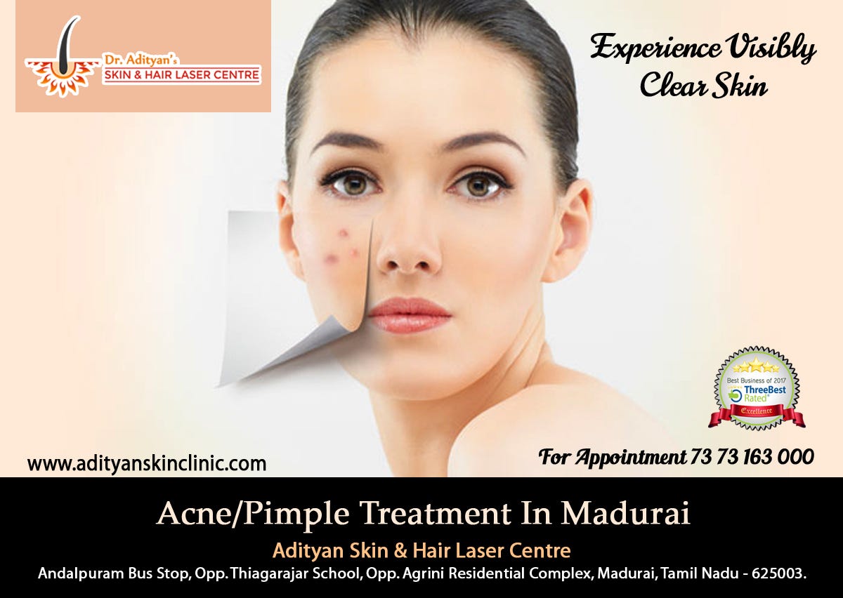 ACNE/PIMPLE TREATMENT IN MADURAI — MAKE YOUR FACE TO SHINE WITH A GLOW | by cecelia | Medium