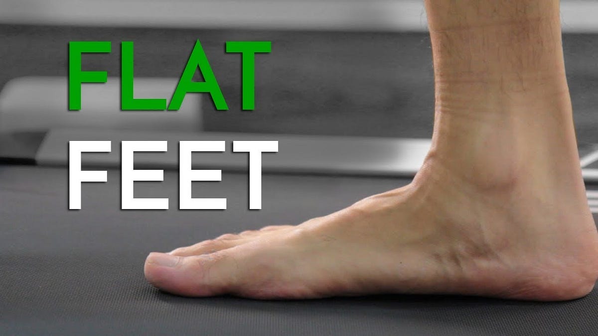 No More Foot Pain: Unlocking the Secrets of Flat Feet and Finding the ...