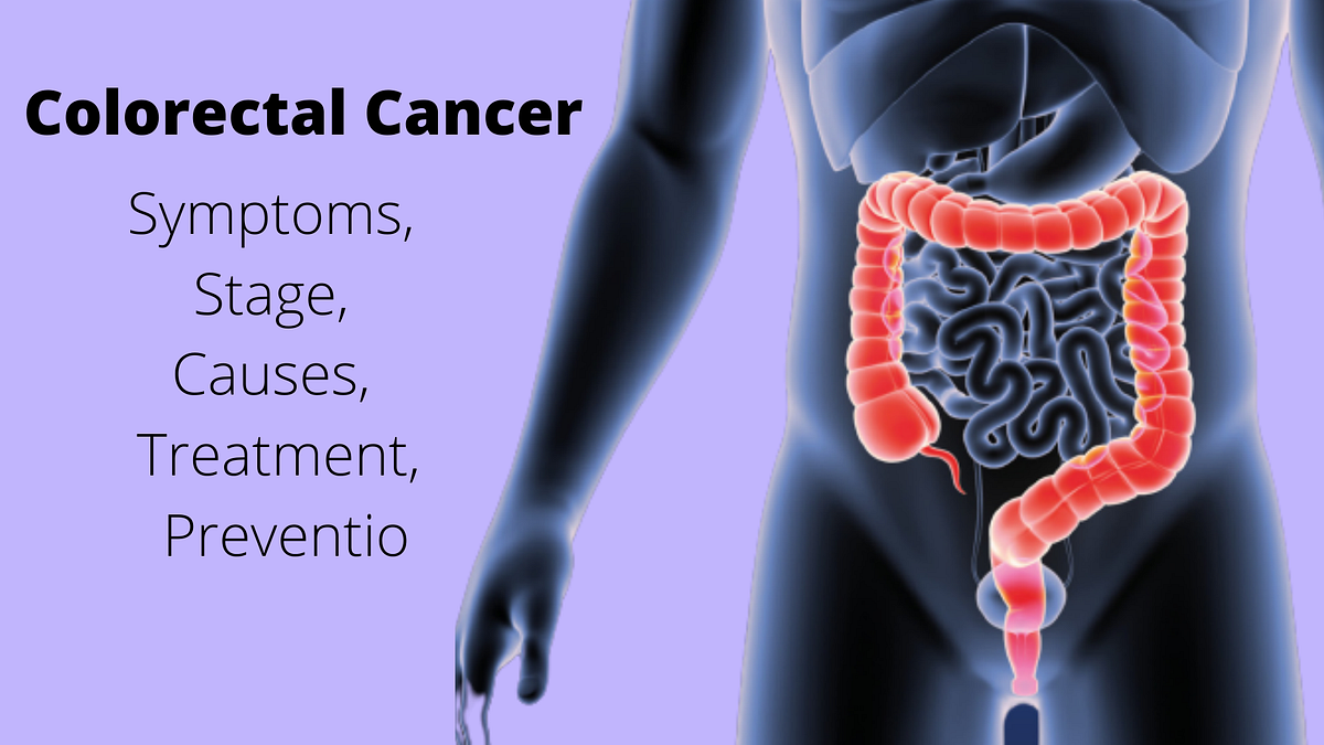 Colorectal Cancer: Symptoms, Stage, Causes, Treatment, Prevention | by ...