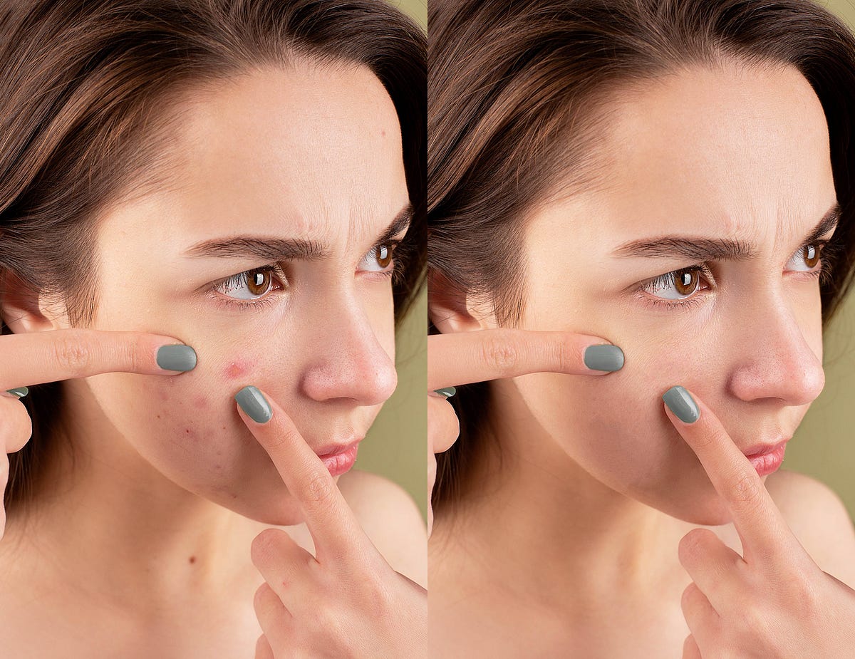 Beauty Retouching service available. - Eliise Anna - Medium