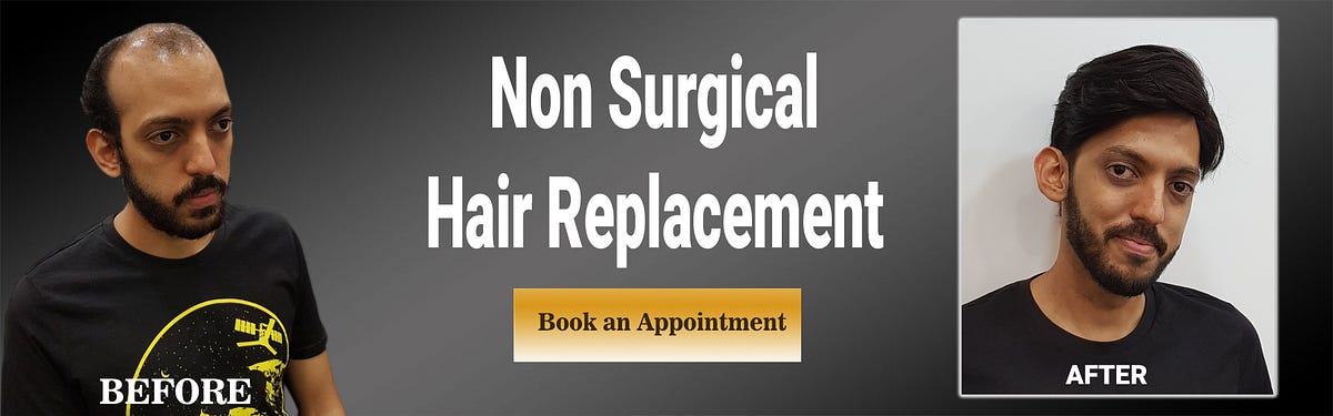 Non-Surgical Hair Replacement Process-Infiniti Hair Club ...