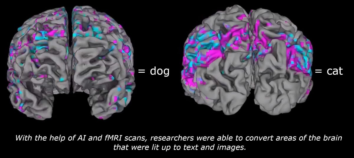 FMRI — Generating text from brain images | by Mike | Medium