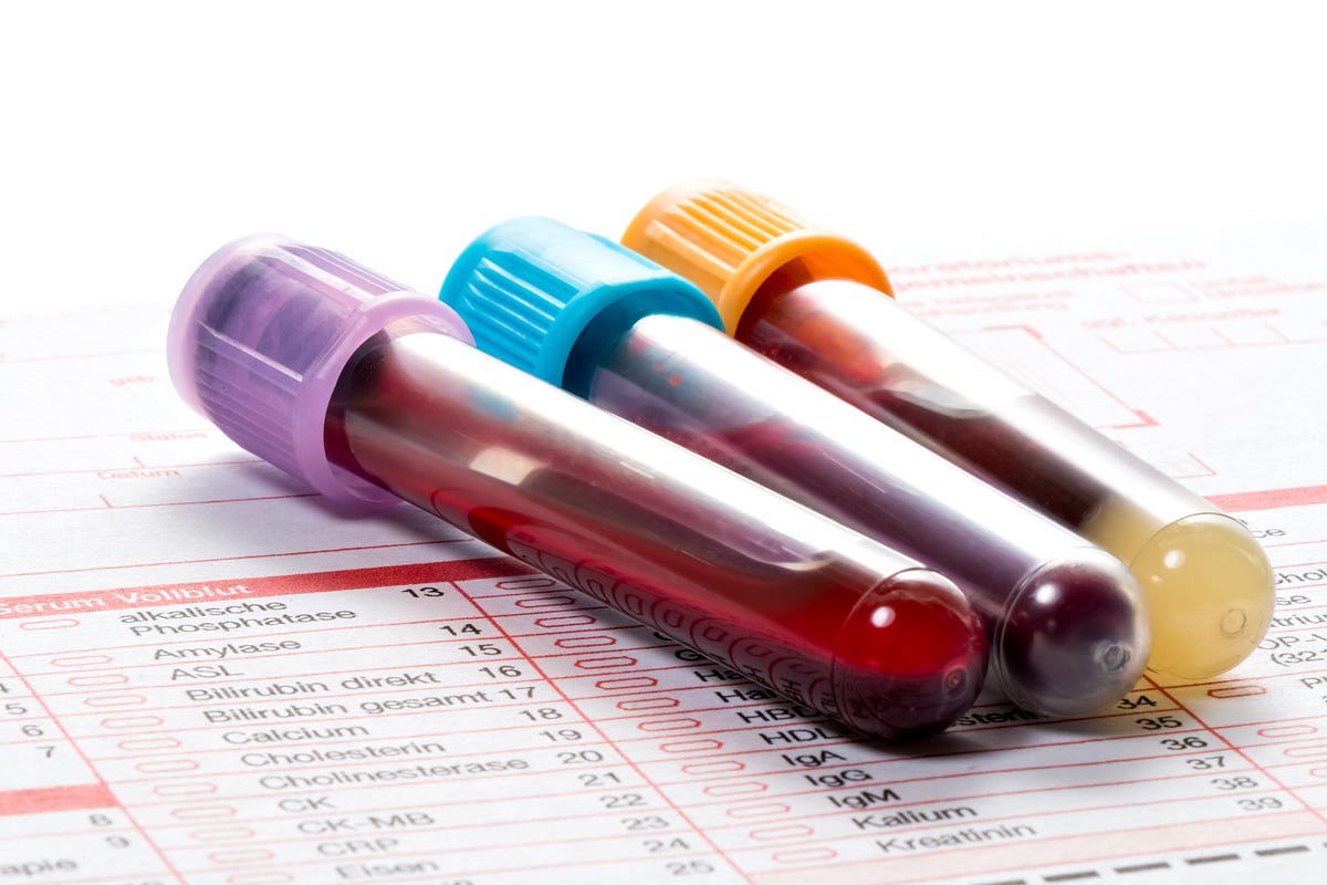 A Primer: Deciphering Blood Work (Lab) Results | by UMiami Health ...