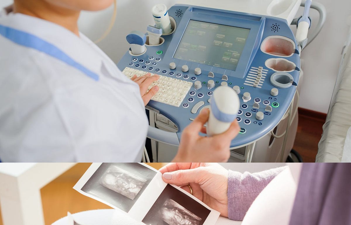 Importance of USG in Women with Dense Breast Tissue | by smitarane ...