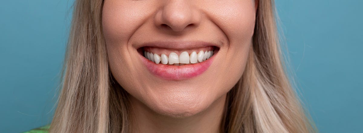 Achieving a Hollywood Smile: The Role of Cosmetic Dentistry | Medium