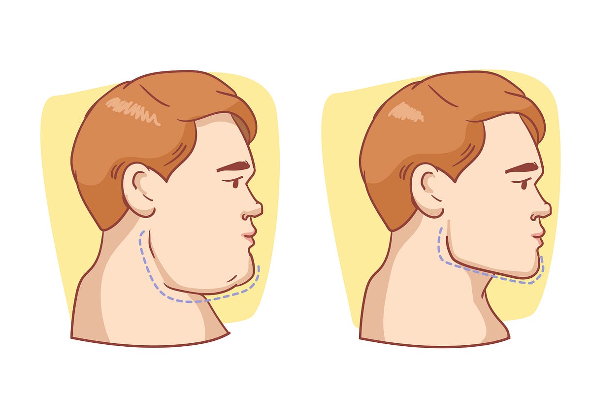 Say Goodbye to Droopy Jowls: Easy Exercises for a Firm Face | by Elle ...