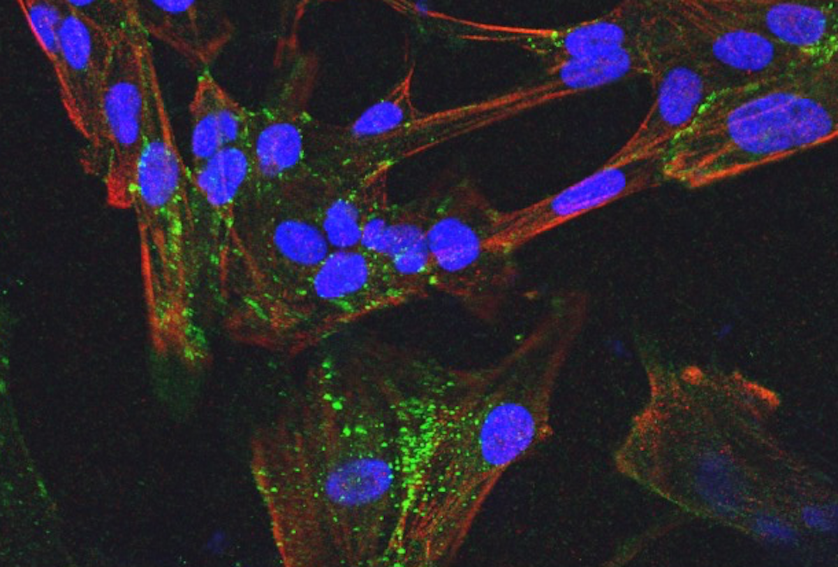 Reprogrammed skin cells test drugs for dangerous side-effects | by ...