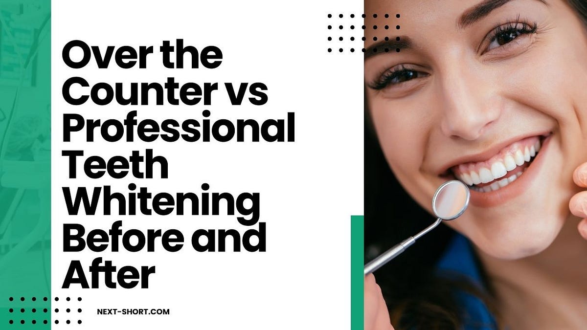 OvertheCounter vs Professional Teeth Whitening Before and After | by ...