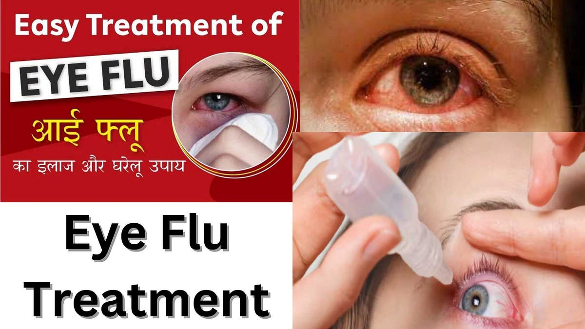 Clear Vision: Effective Eye Flu Treatment for Rapid Relief: Eye Flu ...