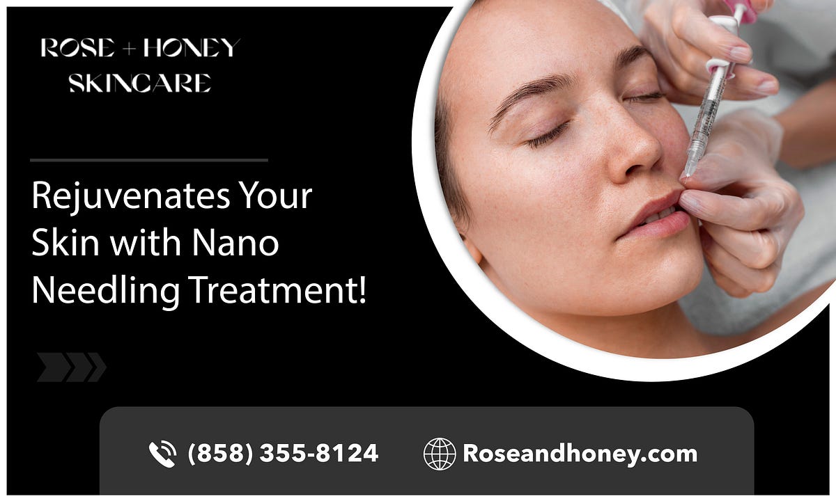 Get Advanced Nano Needling Treatment with Our Experts! - Rose + Honey ...
