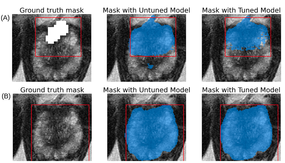SAM in Medical Imaging. Segment Anything Model by Meta AI… | by esin ...