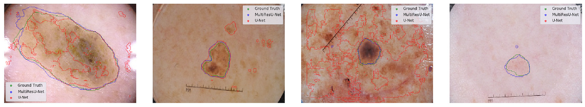 Reading Multiresunet — Rethinking U Net Biomedical Image Segmentation By Sik Ho Tsang Medium