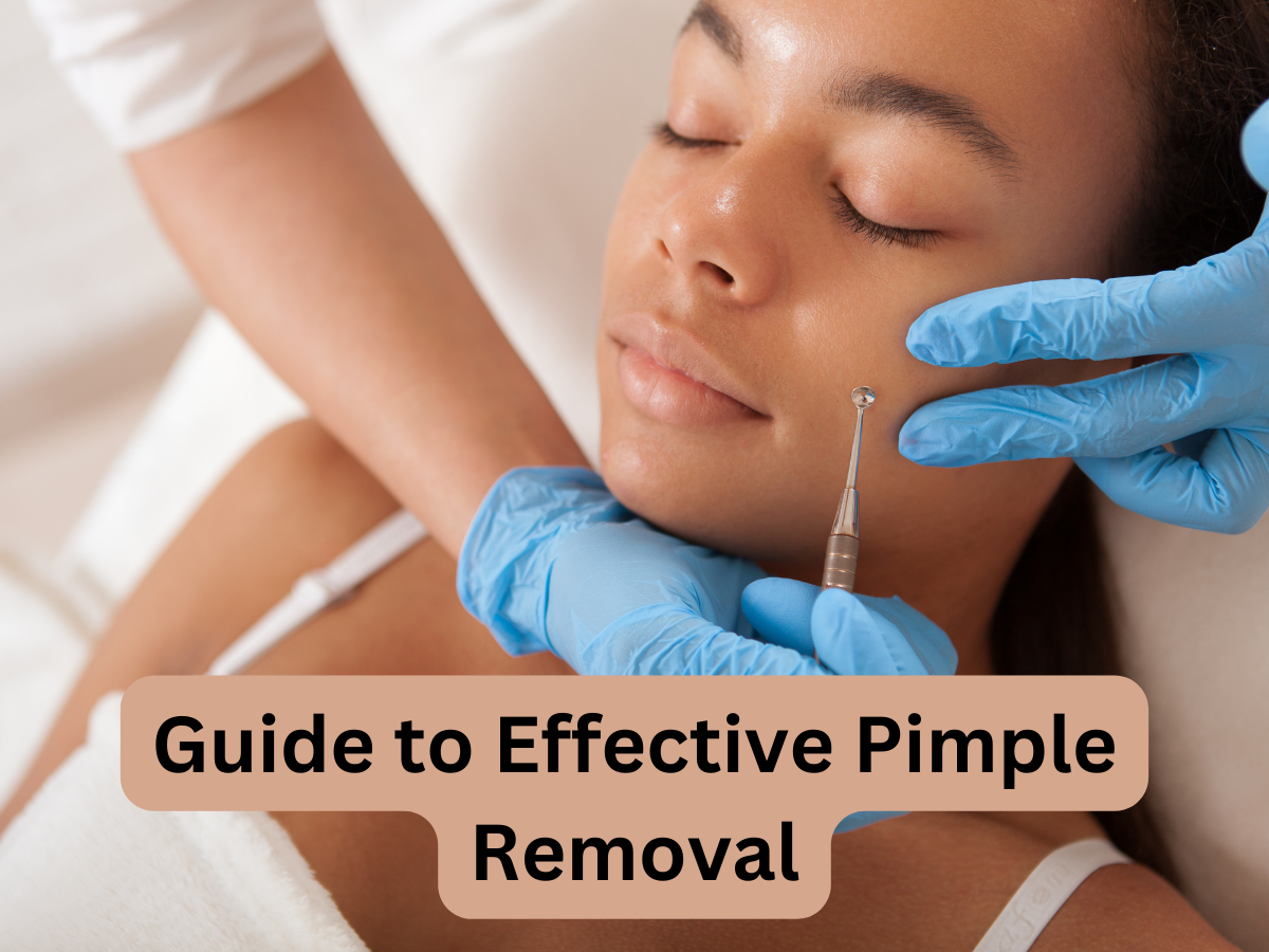 Secrets to Clear Skin: A Guide to Effective Pimple Remova | Medium
