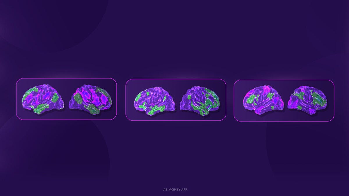 Default state of the brain. Yes, indeed! It’s a peculiar quirk of… | by ...