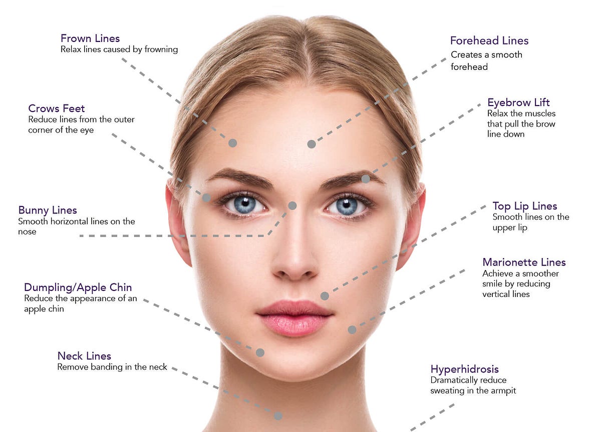 What are the common areas of the face that can be treated with Botox ...