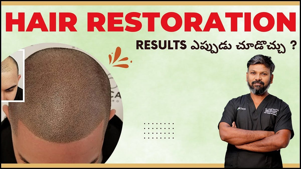 What are some valuable insights into hair restoration procedures ...