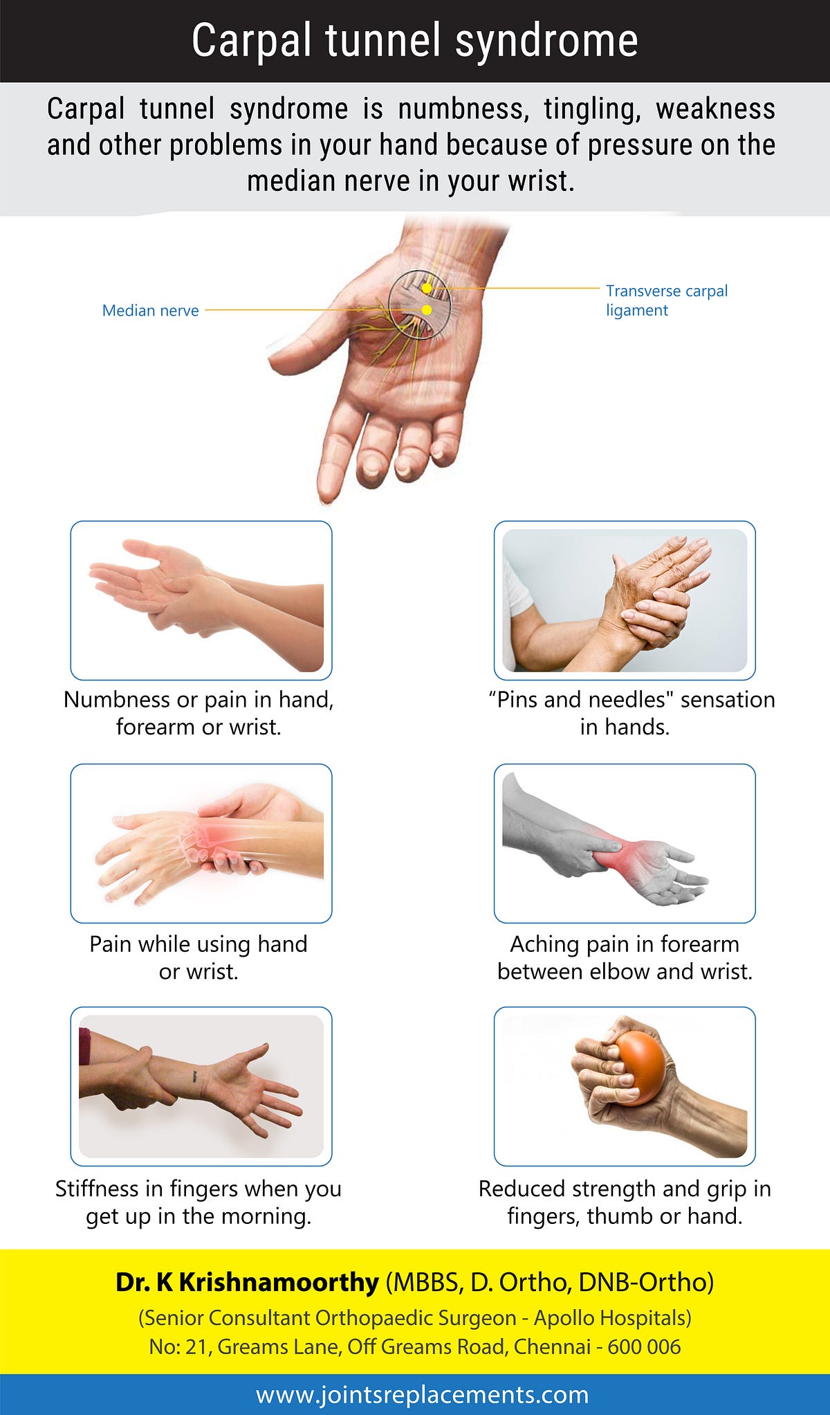 Carpal tunnel Syndrome. A numbness and tingling in the hand and… | by ...
