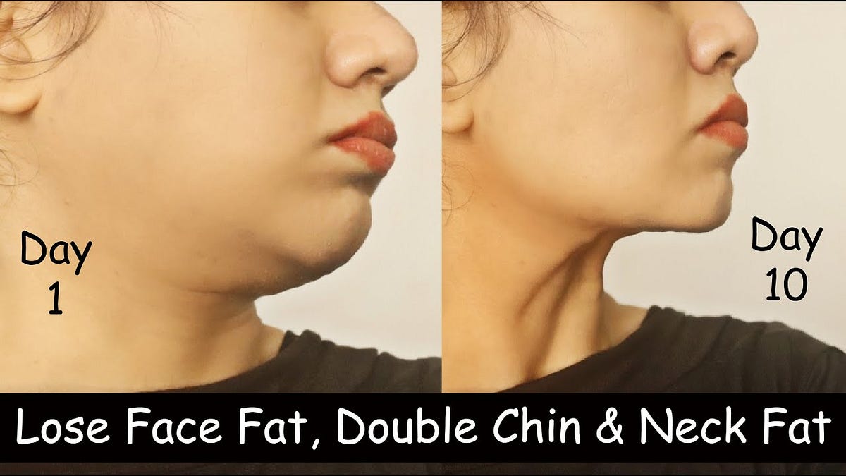How to Lose Double Chin. A Comprehensive Guide: How to Lose… | by ...