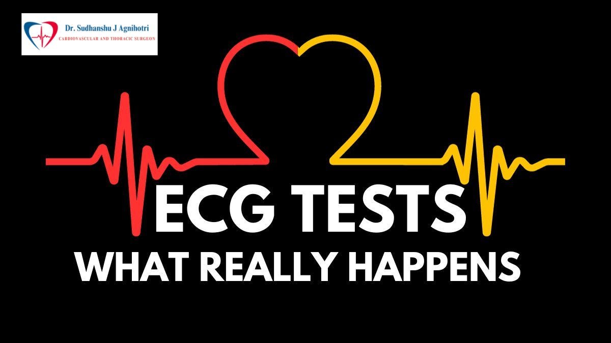 The Truth About ECG Tests: ECG Test Near Me | by Heart Surgeon Indore ...