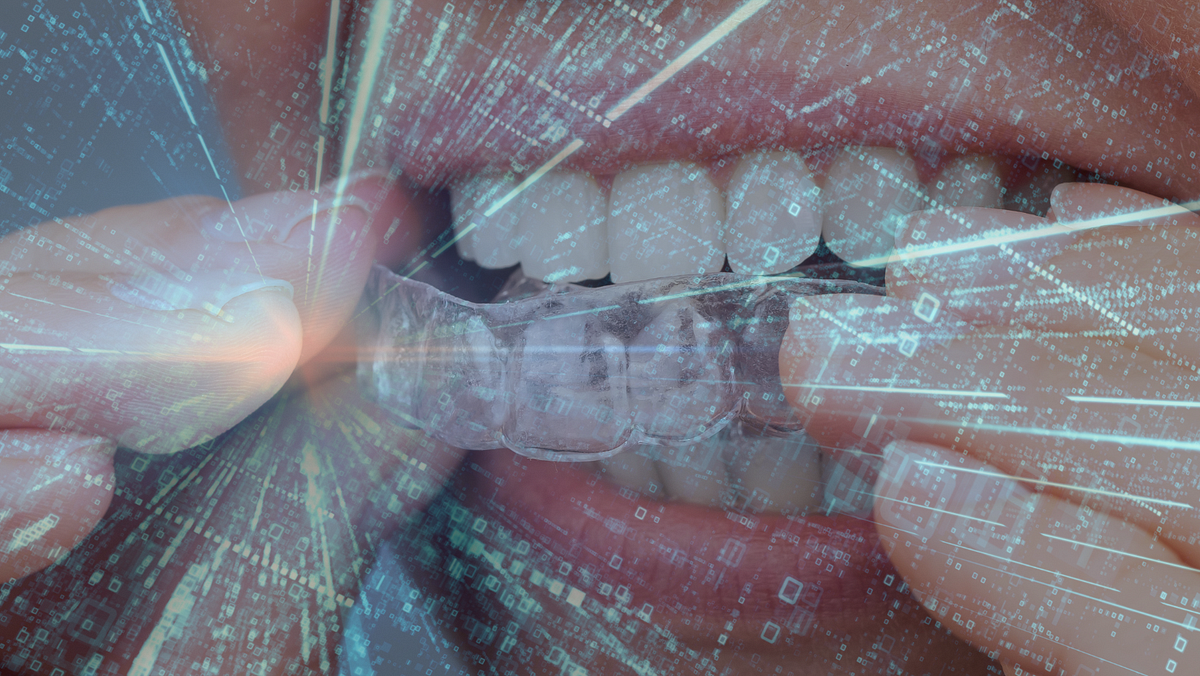 Transforming Smiles: A look at digital orthodontics | by The Immersive ...