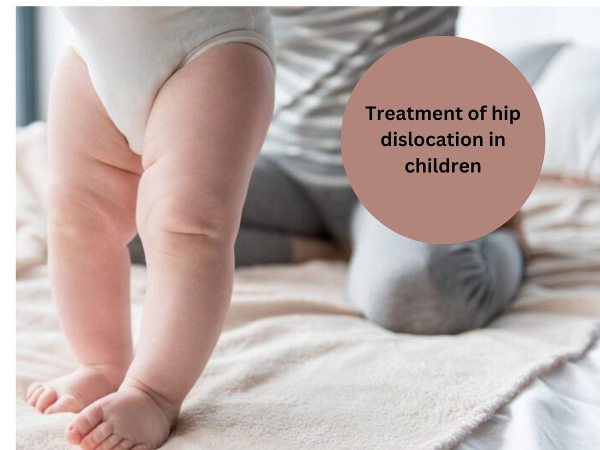 Treatment of hip dislocation in children | by Meysamoskuee | Nov, 2023 ...