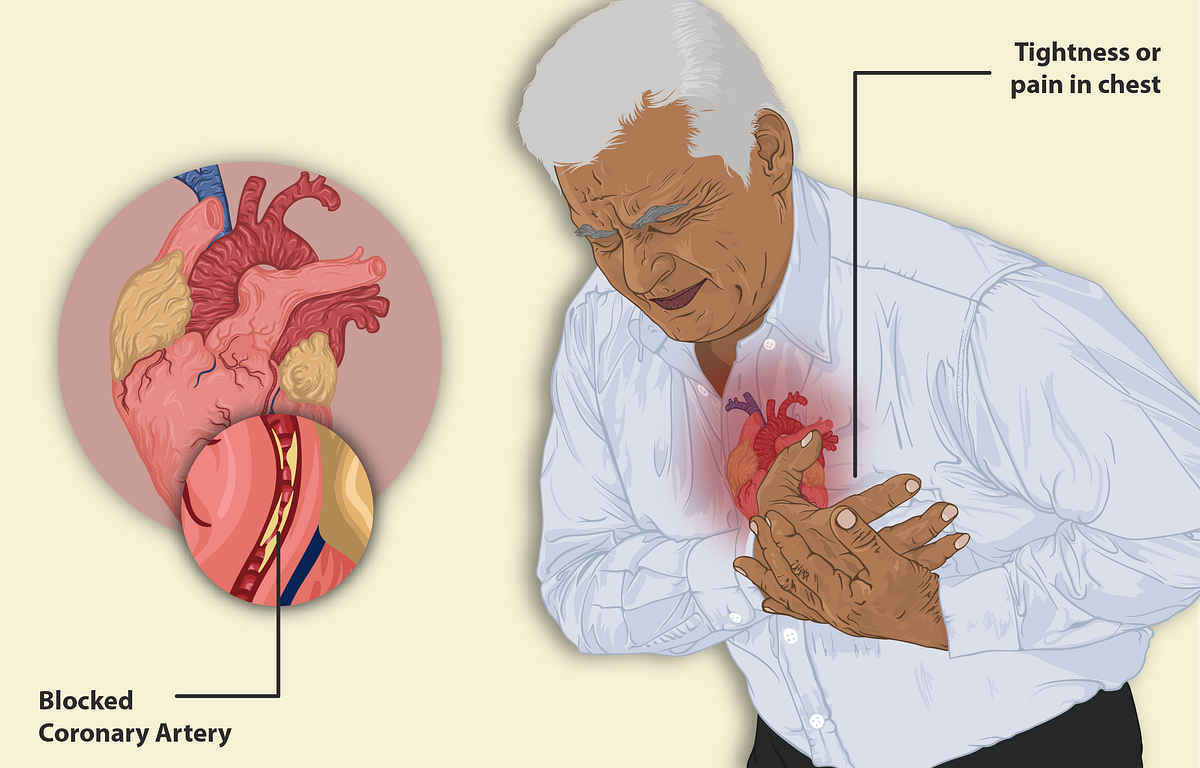 New Chronic Heart Disease Guidelines: Update on GDMT, Imaging, and ...