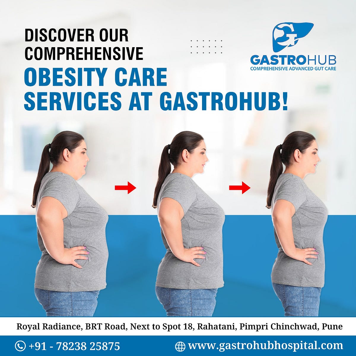 Obesity Care Services at Gastrohub Hospital - Gastrohubhospital - Medium