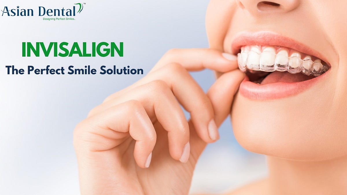 Invisalign in Hyderabad: The Perfect Smile Solution @ Asian Dental ...
